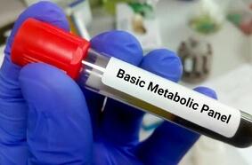 Basic metabolic panel